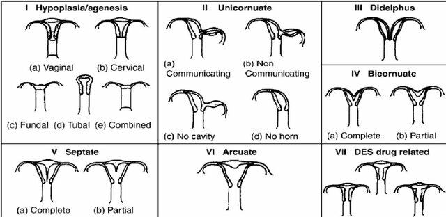 Συγγενείς Ανωμαλίες της Μήτρας - Δρ. Γεώργιος Γρηγοριάδης ...
